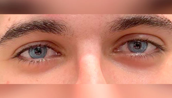 Before & After - Blue Green Medical